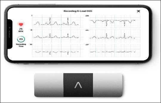 AliveCor brings world’s only six-lead, FDA-cleared personal ECG device ...